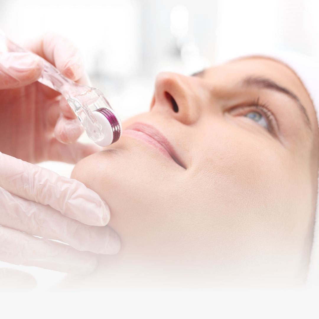 Microneedling Regular – Prédiré Paris Canada