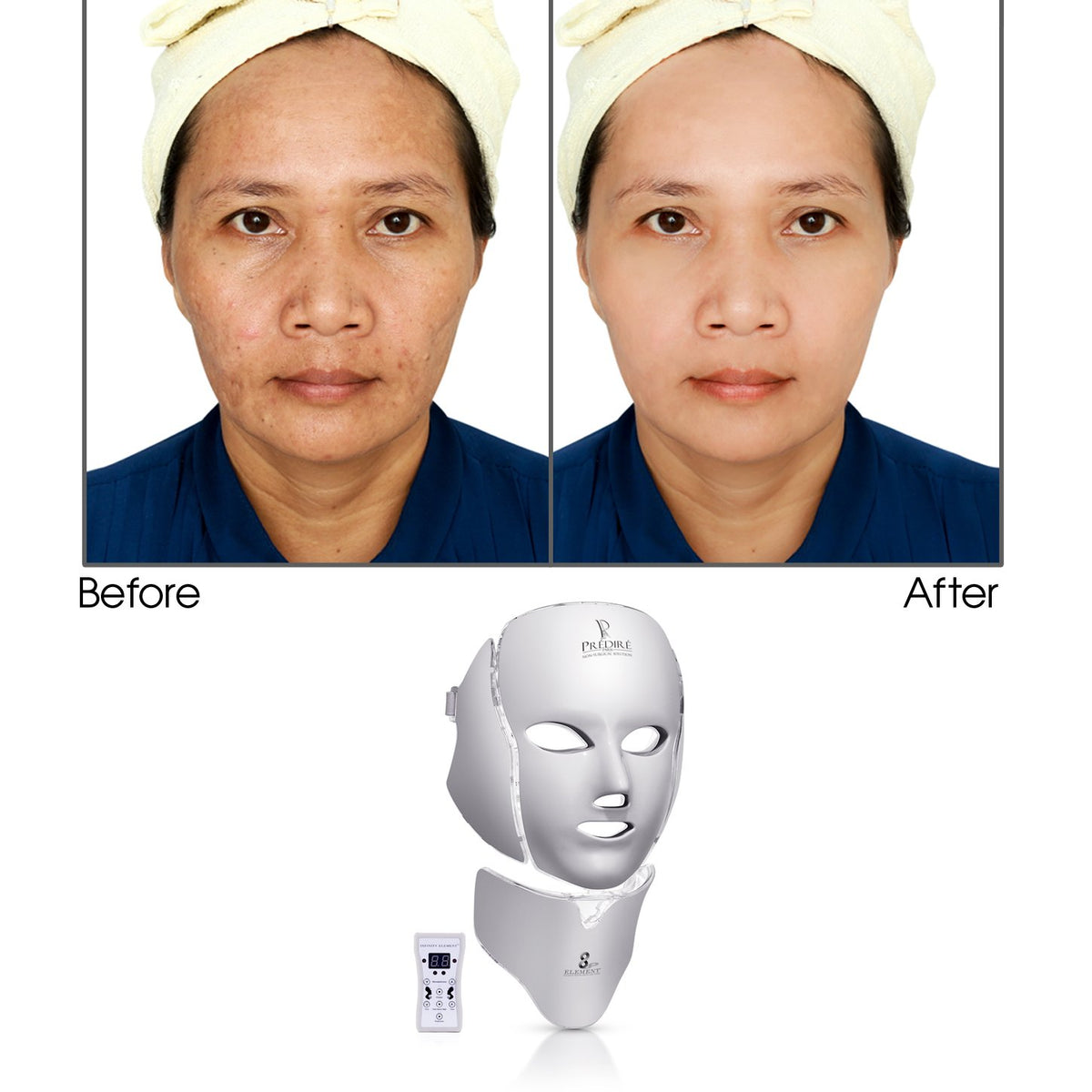 X8 Multi-Purpose LED PHOTON Skincare Mask – Prédiré Paris Canada