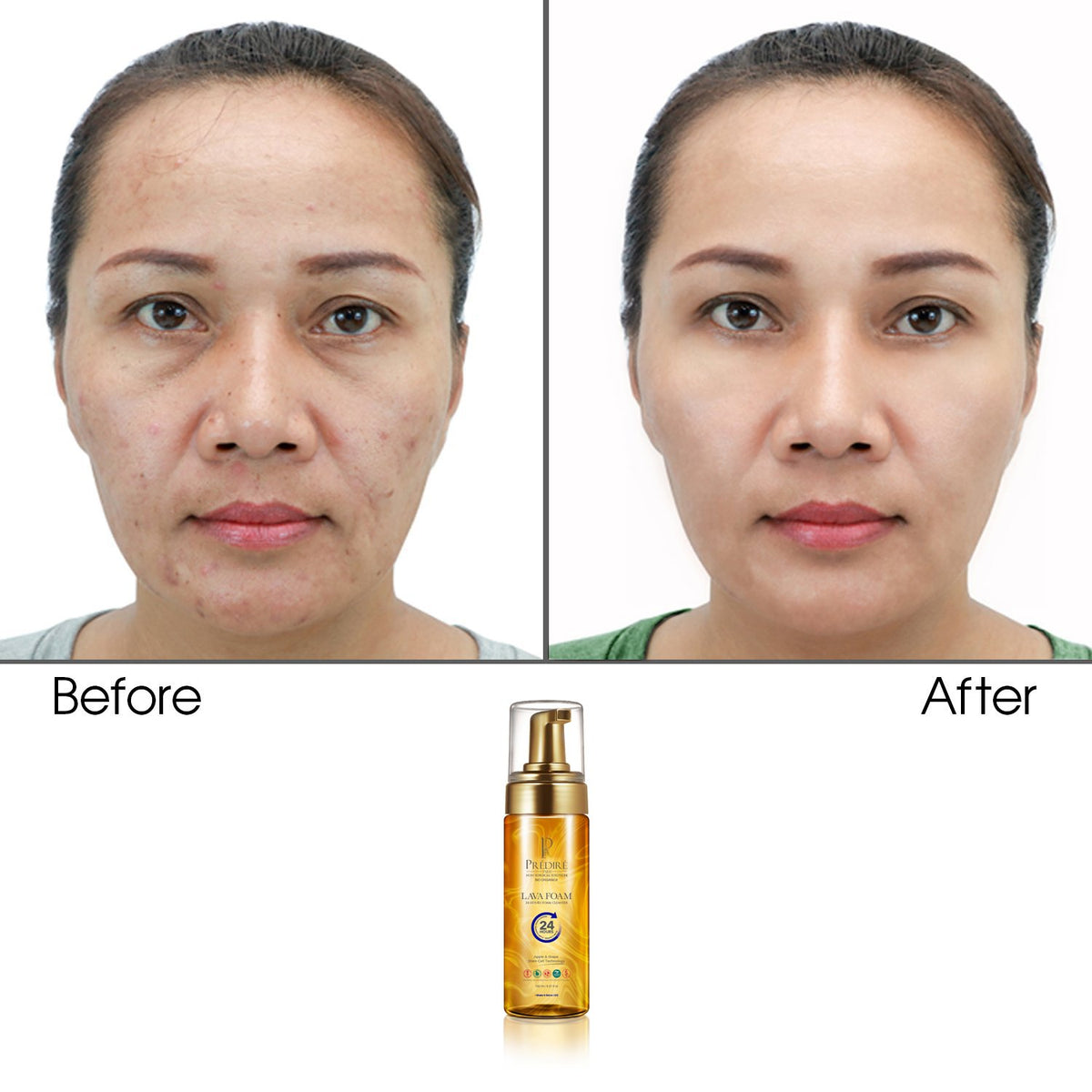 Our foaming facial cleanser gently removes dirt, excess oil and dead ...