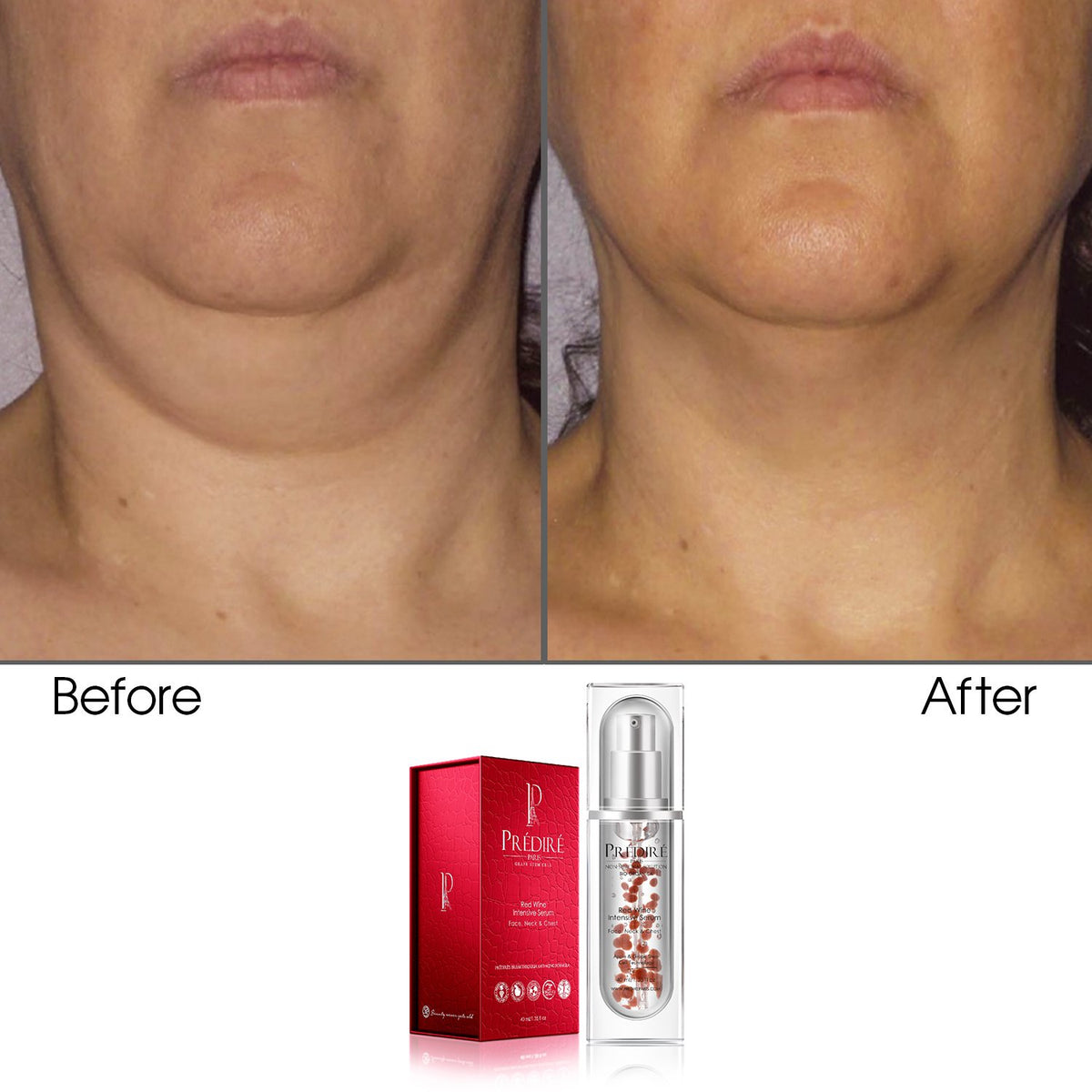 Grape Stem Cell Red Wine Collection - Face, Neck and Chest (Bundle ...